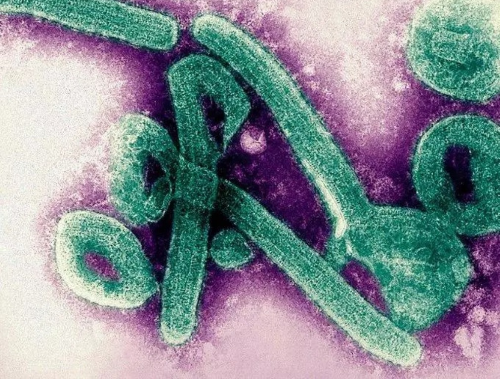 World Health Organization Confirms Highly Infectious Marburg Virus ...